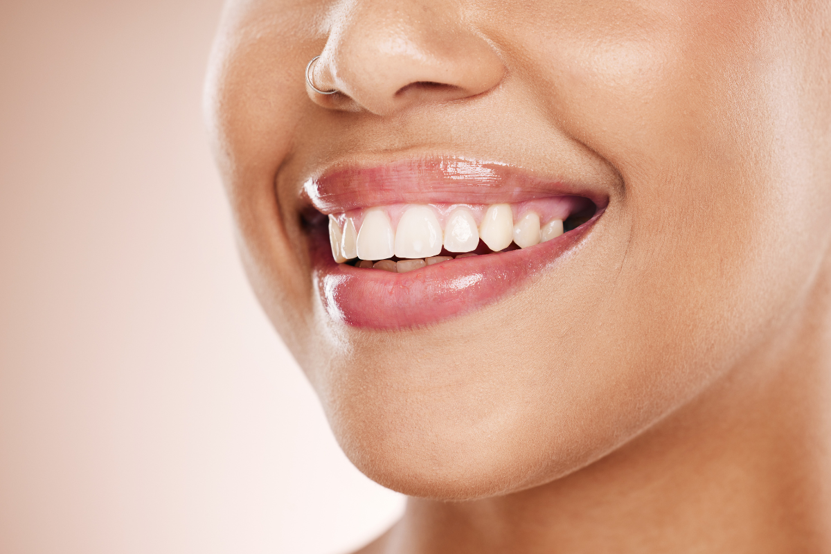 Celebrate this Session with a Whiter, Healthier Smile in Hermitage